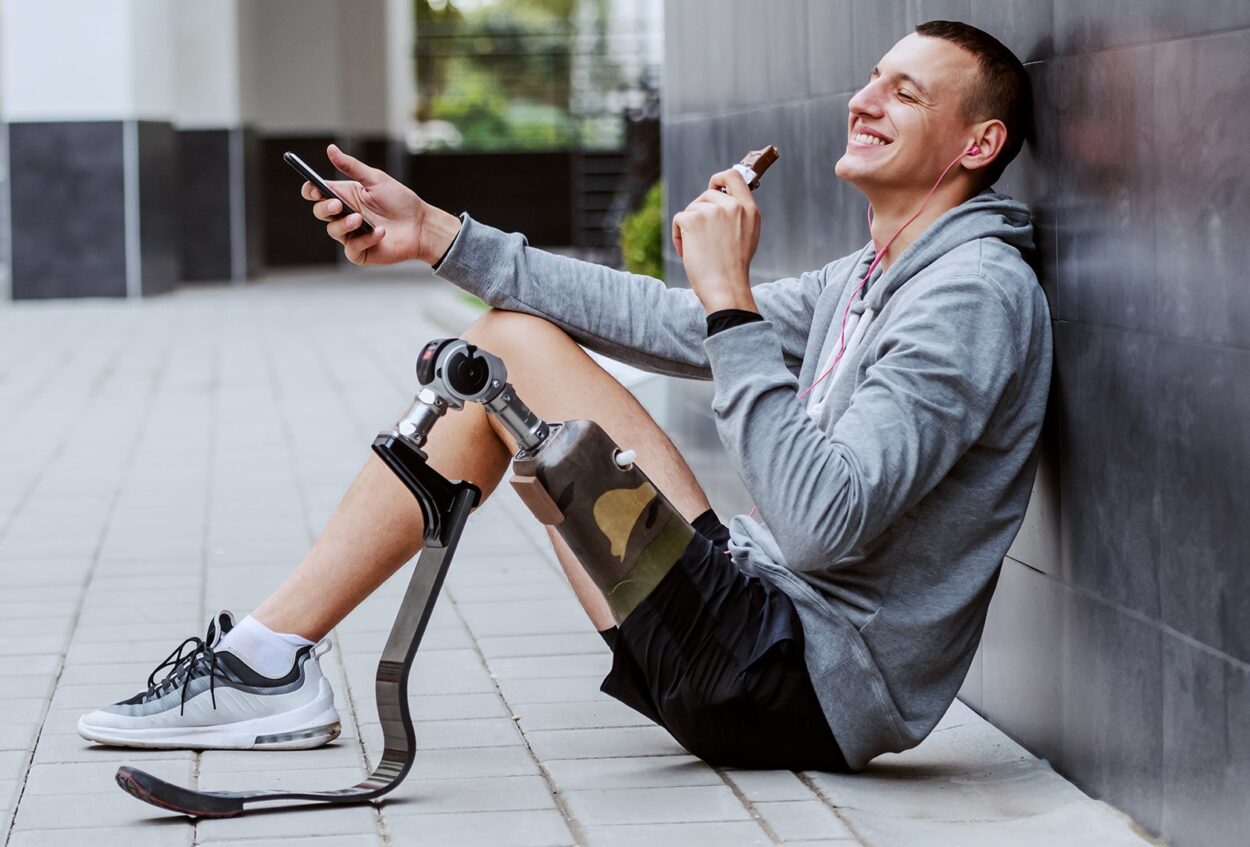 Biomedical Breakthroughs in Prosthetics – Epigenix