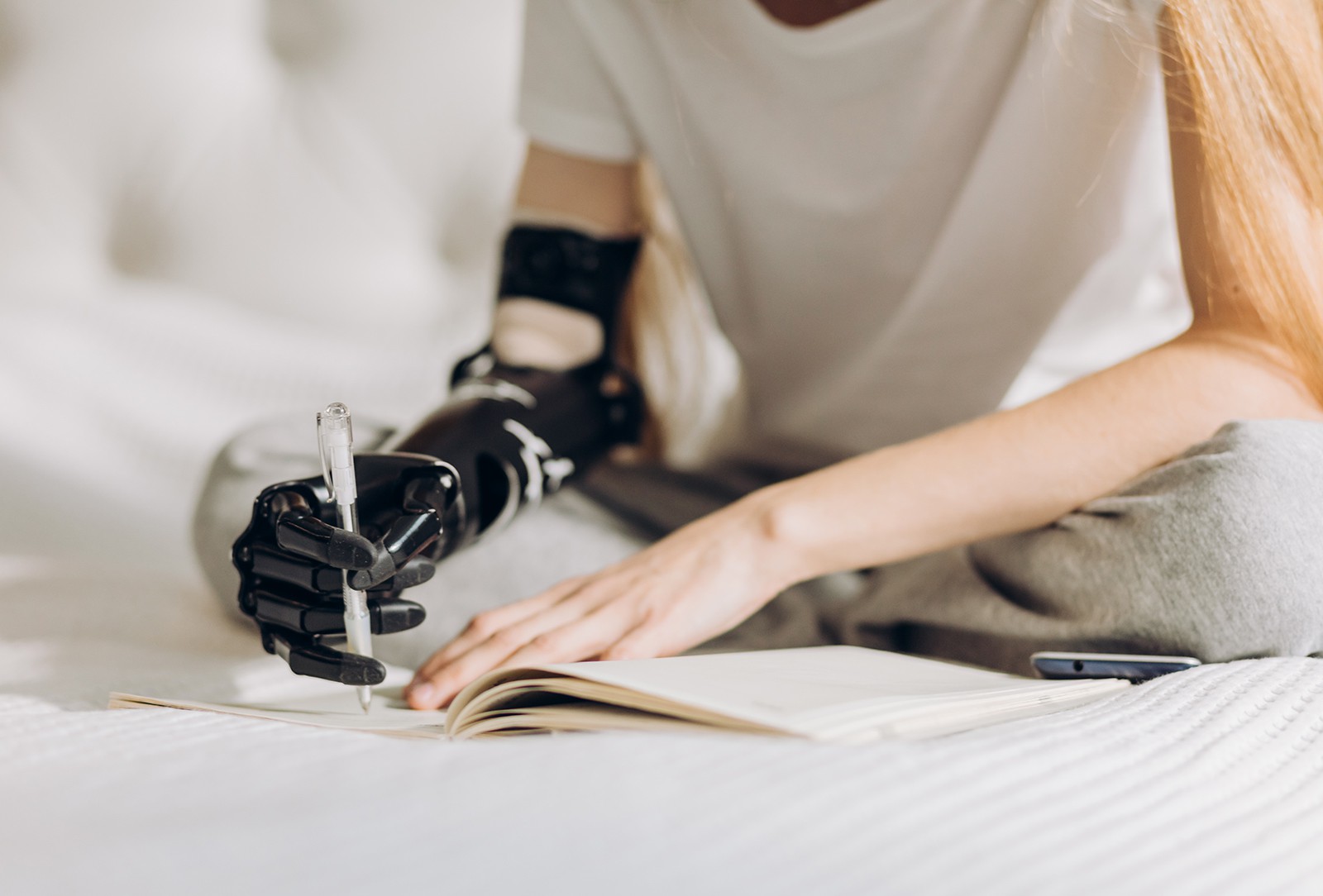 Biomedical Breakthroughs in Prosthetics – Epigenix